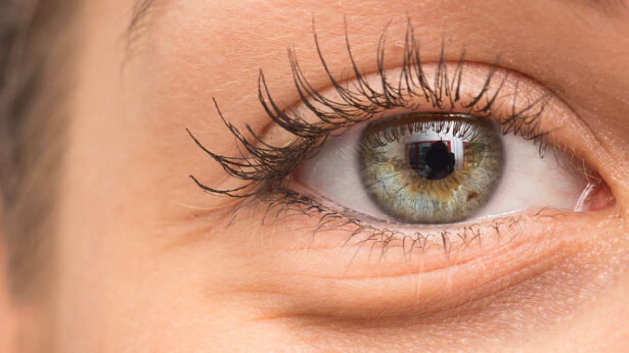 Eyelid Imperfections - Vista Vision Group - Eye Clinics